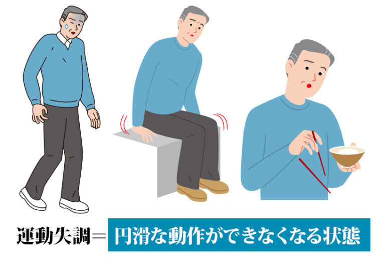 運動失調の原因や評価、リハビリをまとめました | リハビリの一助となりますように