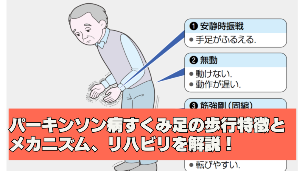 【パーキンソン病】すくみ足の歩行特徴とメカニズム、リハビリを解説 | リハビリの一助となりますように