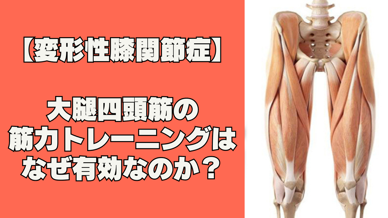 変形性膝関節症に対して大腿四頭筋の筋力トレーニングはなぜ有効なのか？ | リハビリの一助となりますように