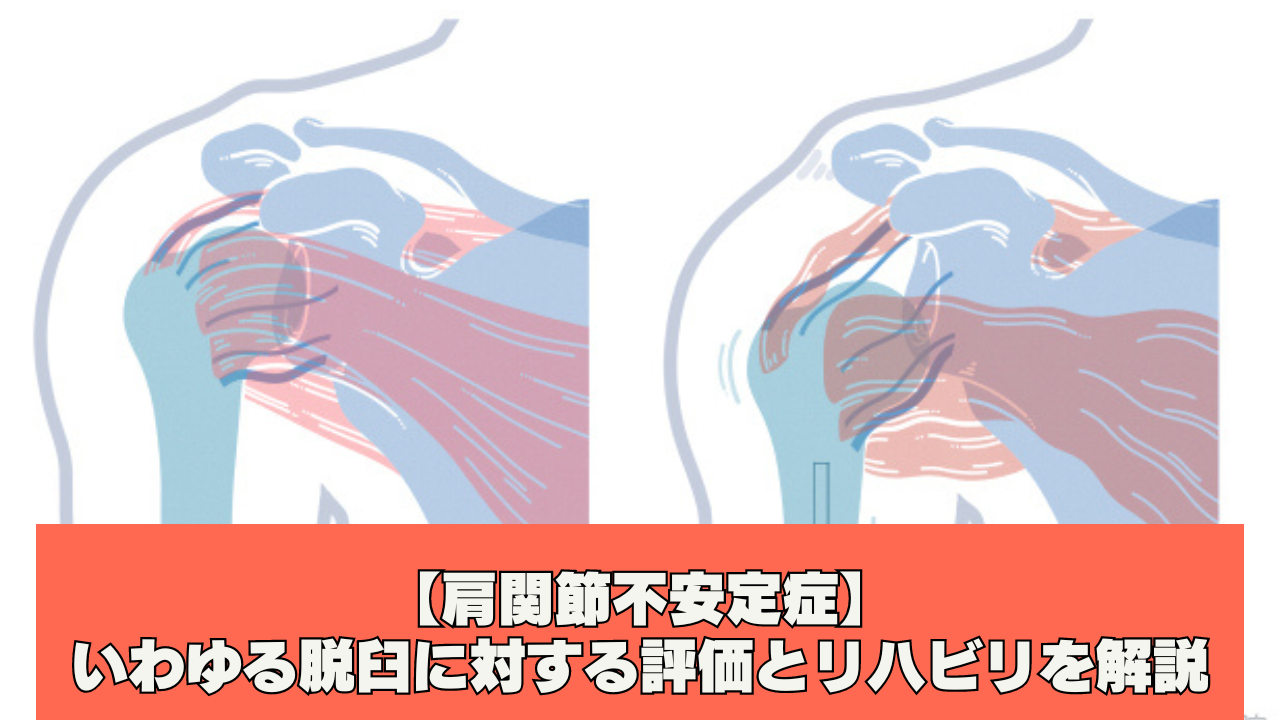 【肩関節不安定症】いわゆる脱臼に対する評価とリハビリを解説 | リハビリの一助となりますように